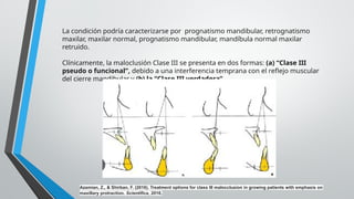 Manejo de maloclusion clase III con tecnica de roth.pptx