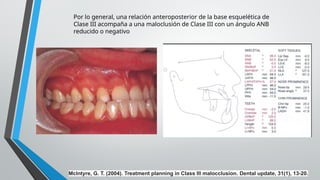 Manejo de maloclusion clase III con tecnica de roth.pptx