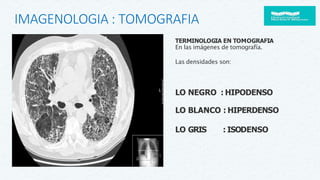 CLASE I IMAGENOLOGIA.pptx