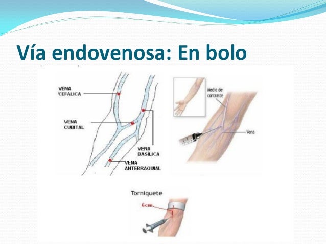 Clase Inyectoterapia