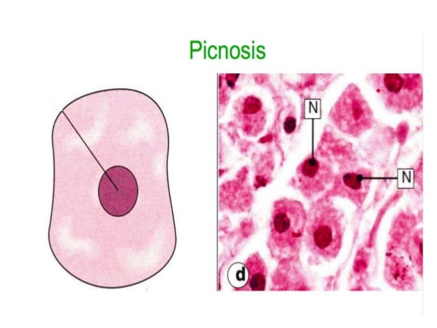 Lesión y Muerte Celular