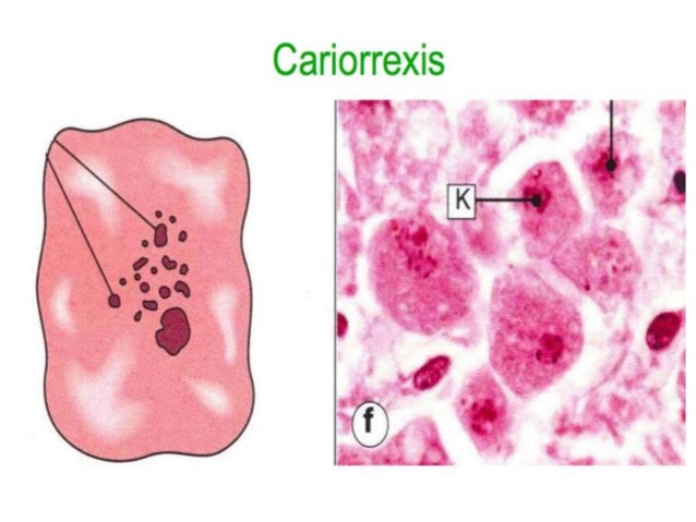 Lesión y Muerte Celular