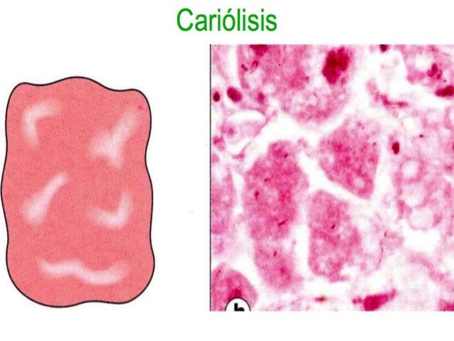 Lesión y Muerte Celular