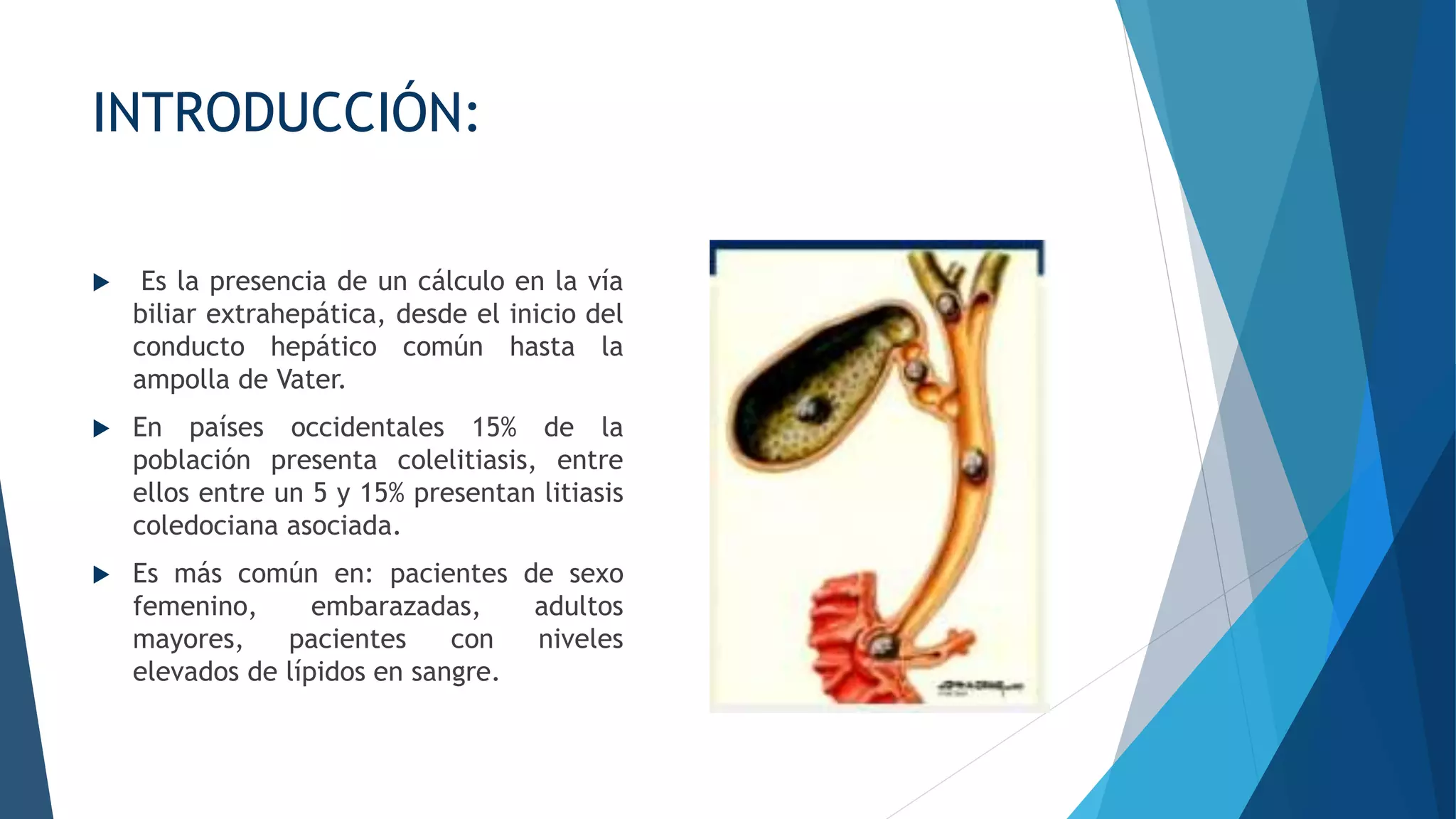 LITIASIS COLEDOCIANA.pptx