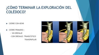 LITIASIS COLEDOCIANA.pptx