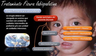 Fisura Labiopalatina y Labio Leporino | PPSX