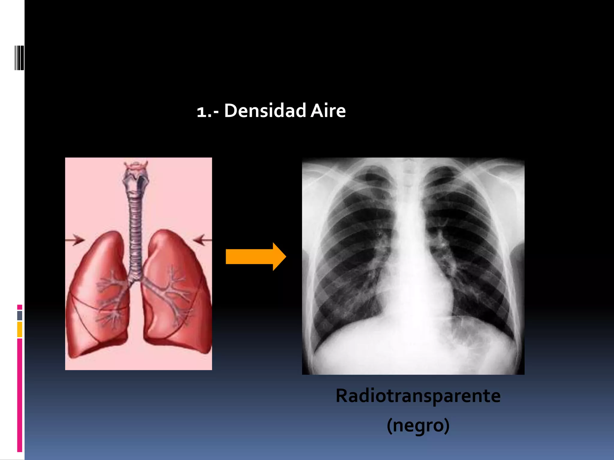 rx simple de torax y abdomen | PPT