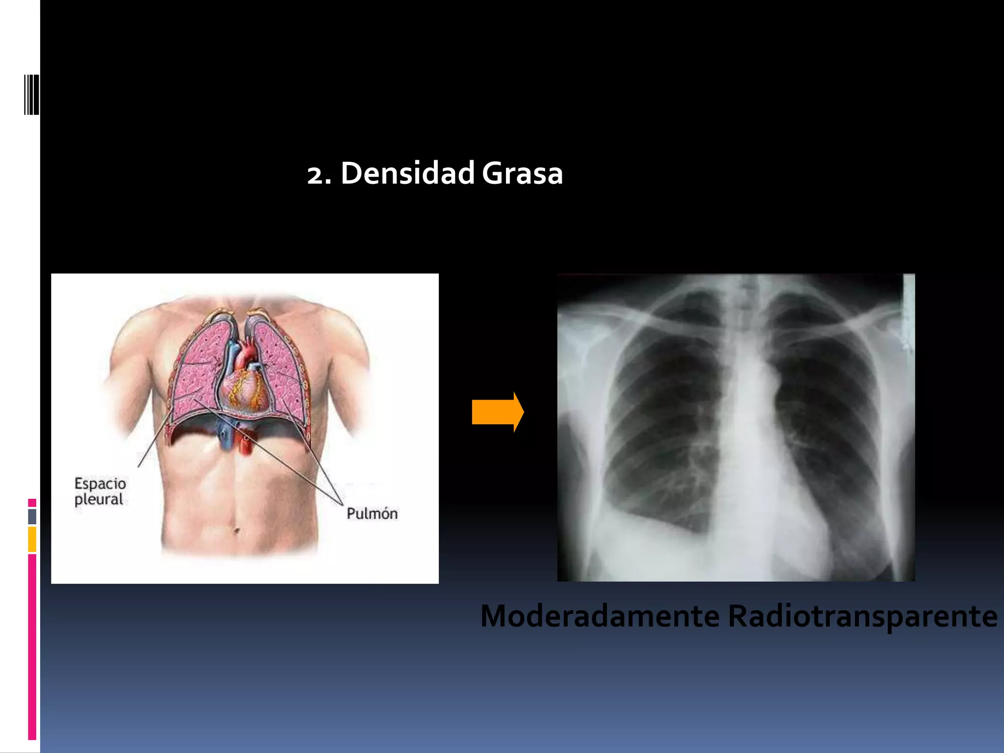 rx simple de torax y abdomen | PPT