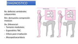 Deformaciones de la columna vertebral en los p | PPTX