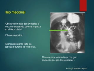 CLASE PATOLOGIA QUIRUGICA DE INTESTINO DELGADO UCSM 2020.pptx