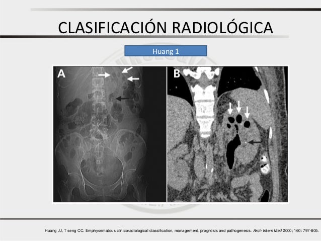 Clase pielonefritis enfisematosa huang