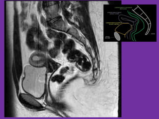 Clase pelvis 2015 final | PPTX
