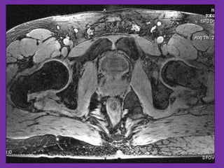 Clase pelvis 2015 final | PPTX