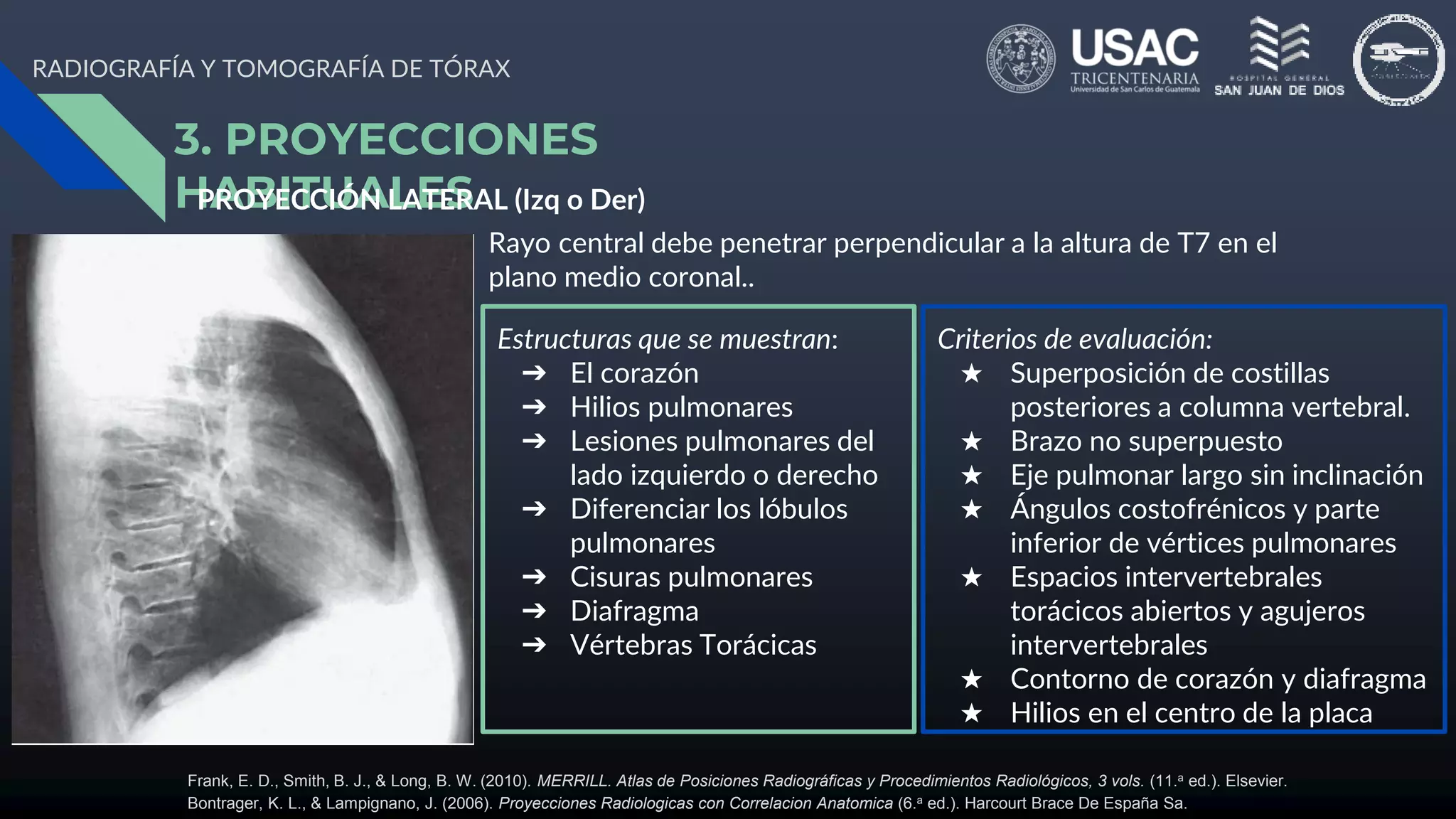 TORAX RADIOLOGIA | PPT