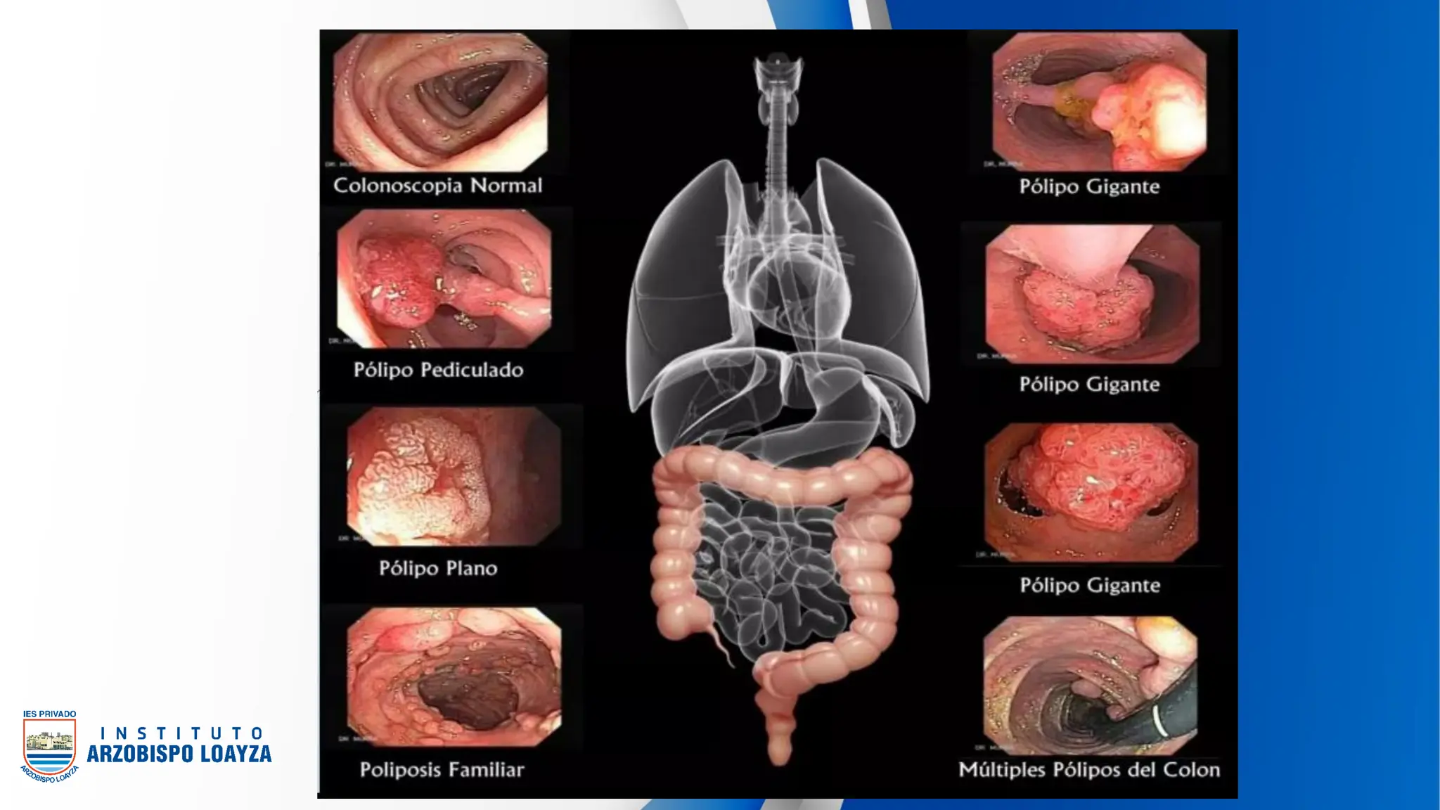CLASES 7 -I ENDOSCOPIA-LAPAROSCOPIA-COLONOSCOPIA (2).pdf
