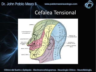 Clases clinica neurologia cefalea tensional fisioterapia | PPTX
