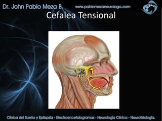 Clases clinica neurologia cefalea tensional fisioterapia | PPTX