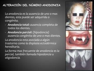 trastornos de los órganos dentarios | PPTX