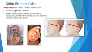 clase semiologia OIDOsemiologia de oido.pptx