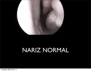 Clase sinusitis aguda y cronica 2012 | PDF