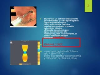 SINDROME PILORICO 2019 | PPTX