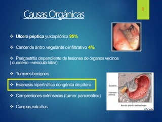SINDROME PILORICO 2019 | PPTX