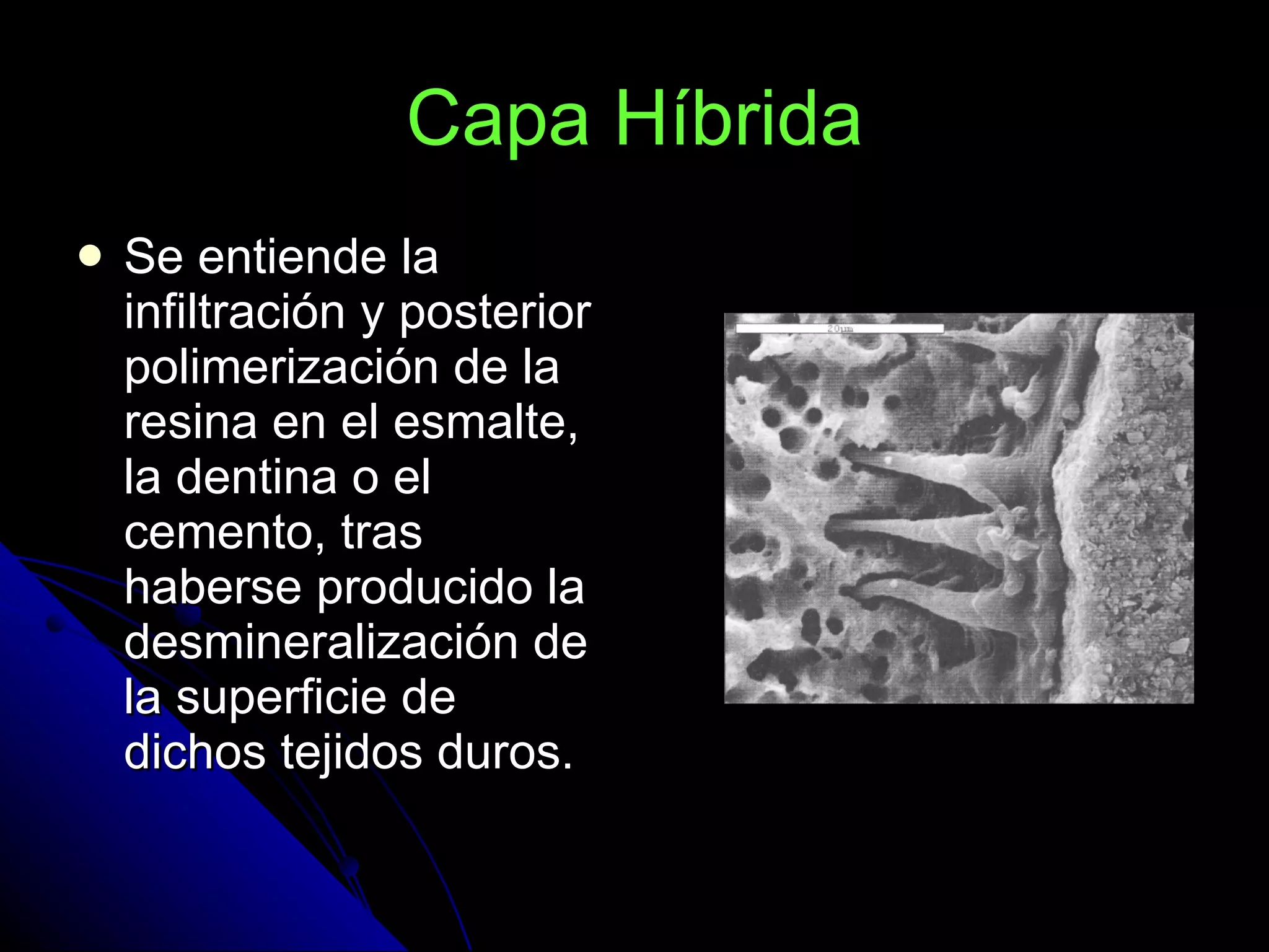 Clases resinas compuestas | PPT | Dental Health | Diseases and Conditions