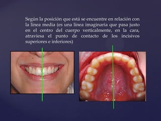 Clase superficies dentarias | PDF