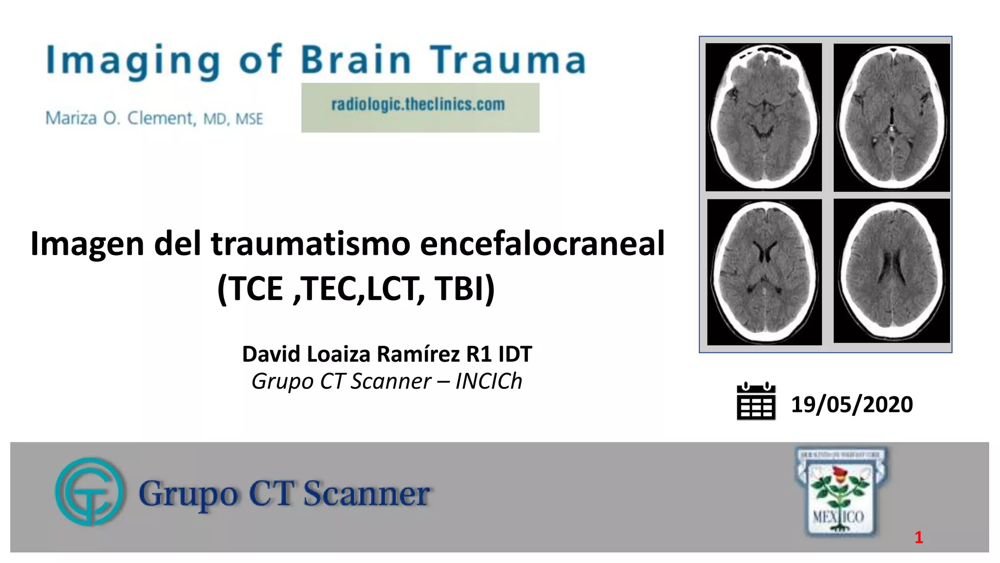 Imagen en traumatismo encefalo craneal , (TCE,TEC,LCT,TBI) | PPTX