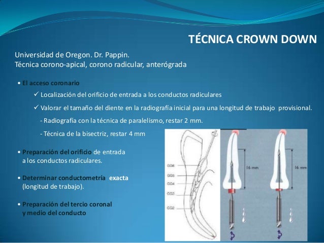 Instrumentacion (endodoncia)