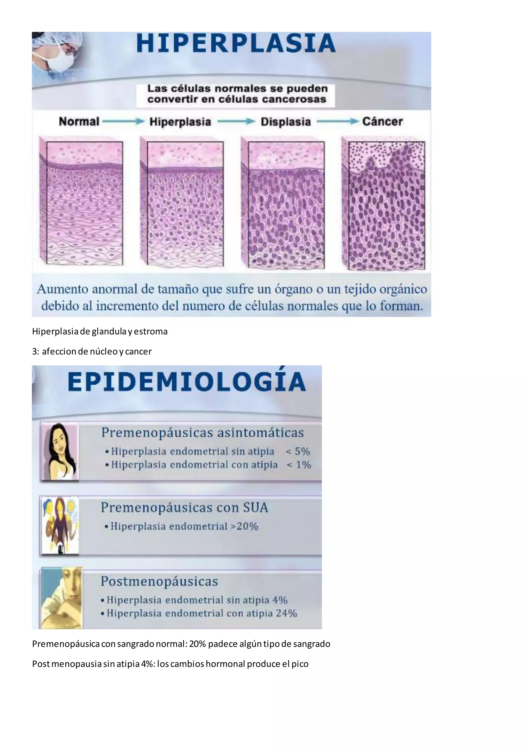 Clase teoría hiperplasia endometrial | PDF
