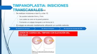 CIRUGIA DE TIMPANOPLASTIA Y OSICULOPLASTIA | PPTX