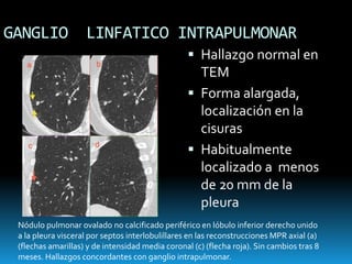 Clase torax2 | PPTX