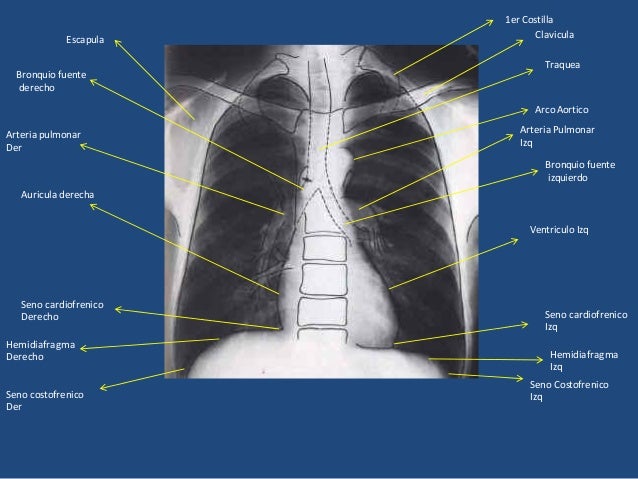 Clase torax normal - Diagnostico por Imagenes - Barcelo