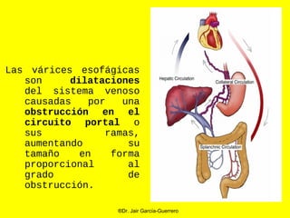 Várices esofágicas | PPT