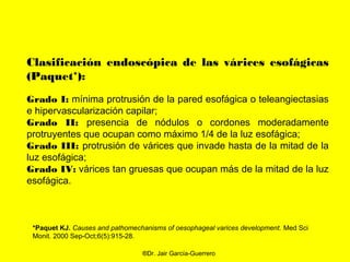 Várices esofágicas | PPT