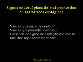 Várices esofágicas | PPT