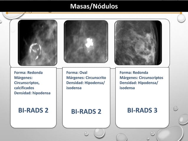 Clasificación birads mx y usg