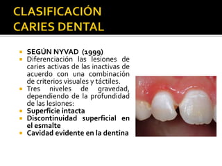 Clasificación de caries dental | PPTX