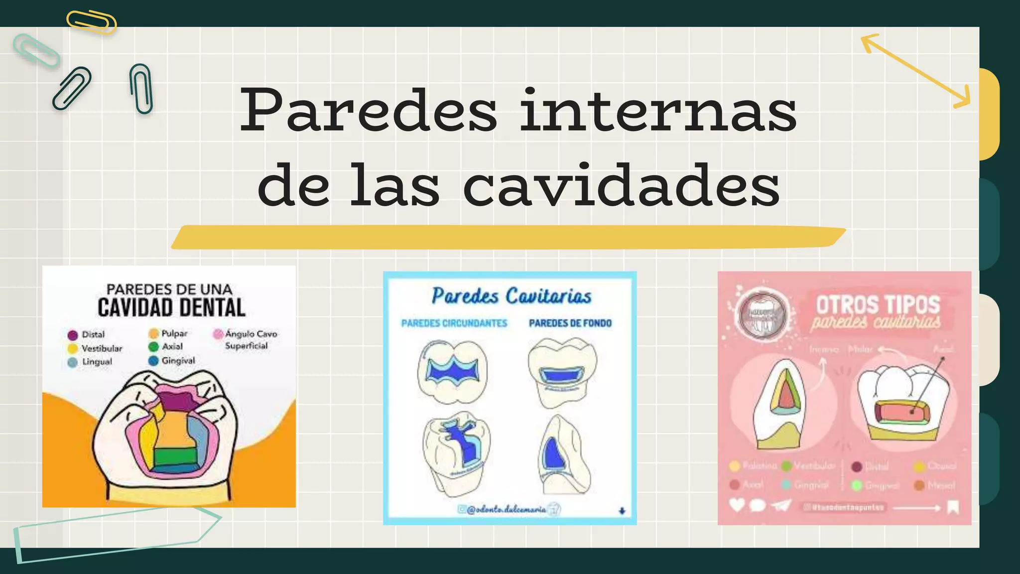 CLASIFICACIÓN DE CAVIDADES.pptx