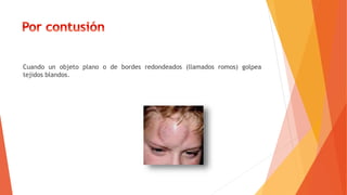 Clasificación de heridas cirugia | PPTX