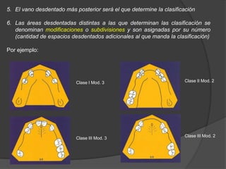 Clasificación de kennedy | PPTX