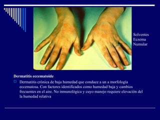 Clasificación de las dermatitis profesionales | PPT