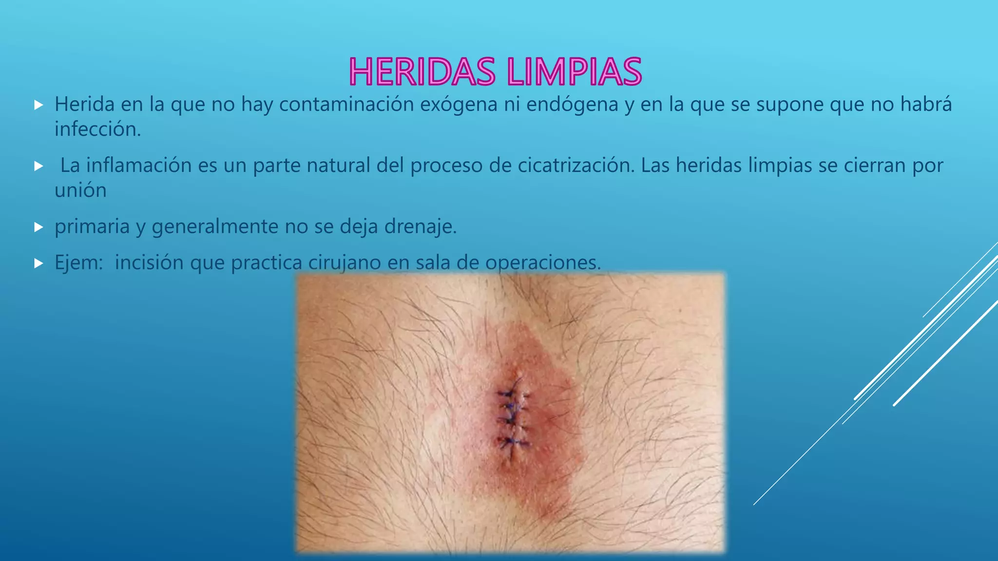 CLASIFICACIÓN DE LAS HERIDAS-DIAPOS-CIRUGIA.pptx