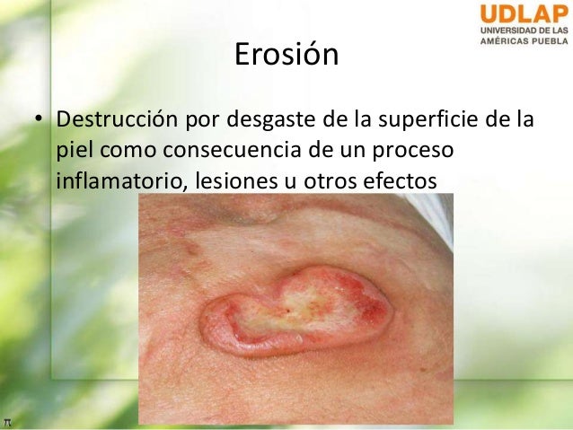 Clasificación de lesiones dermatologicas