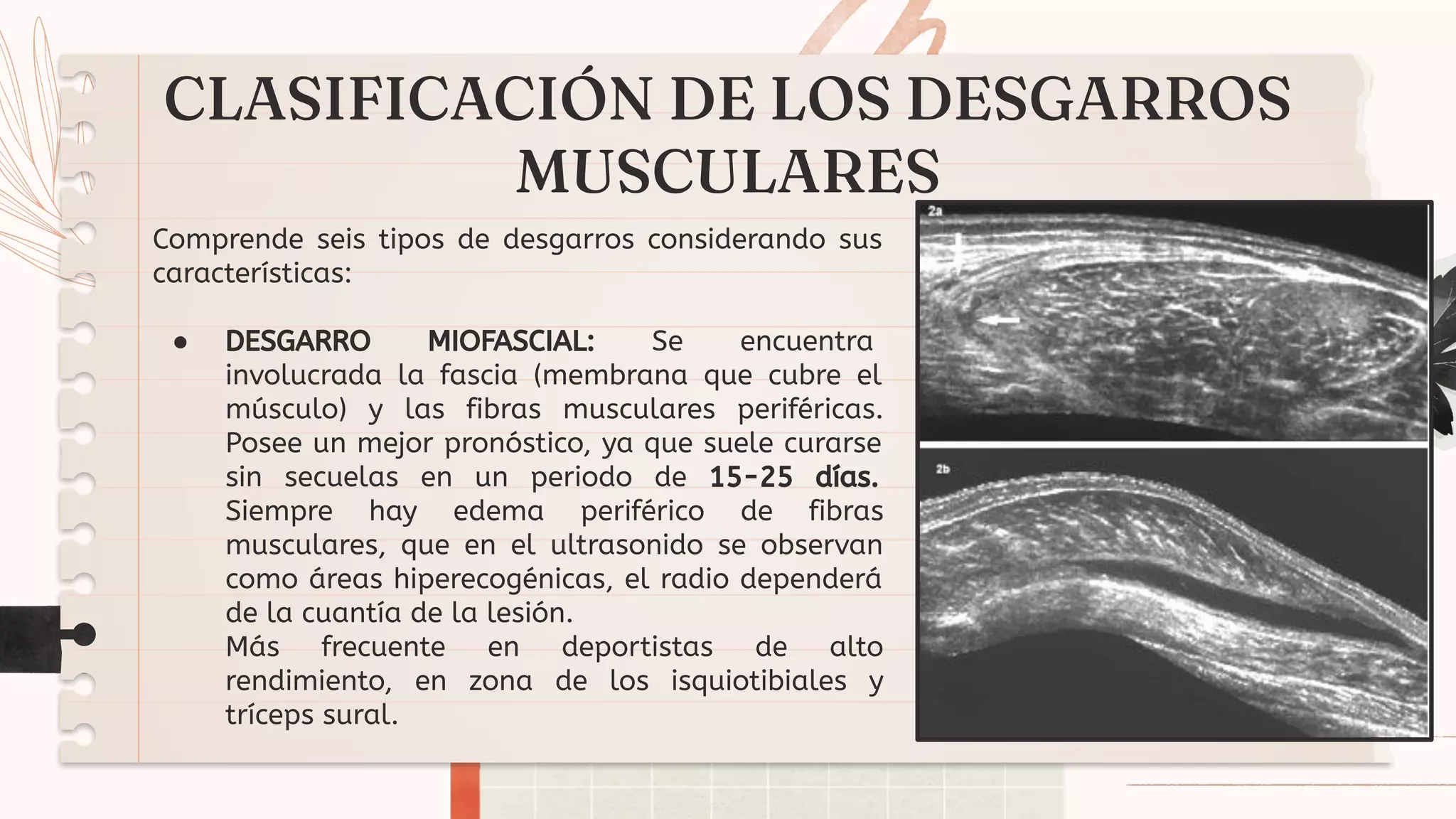 Clasificación de los desagarros musculares.pdf