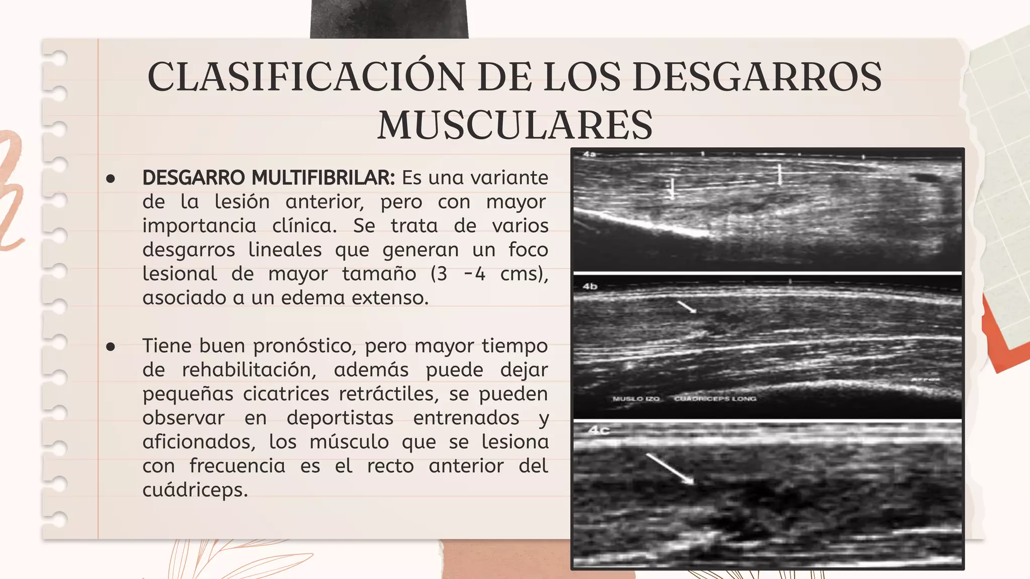 Clasificación de los desagarros musculares.pdf