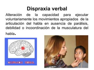 Clasificación de los trastornos de la comunicación | PPTX