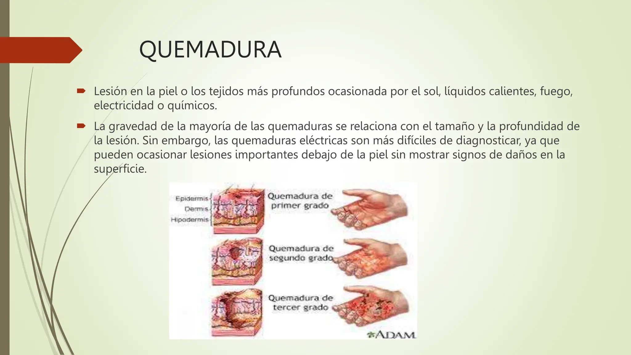 Clasificación de Quemaduras y Primeros Auxilios.pptx