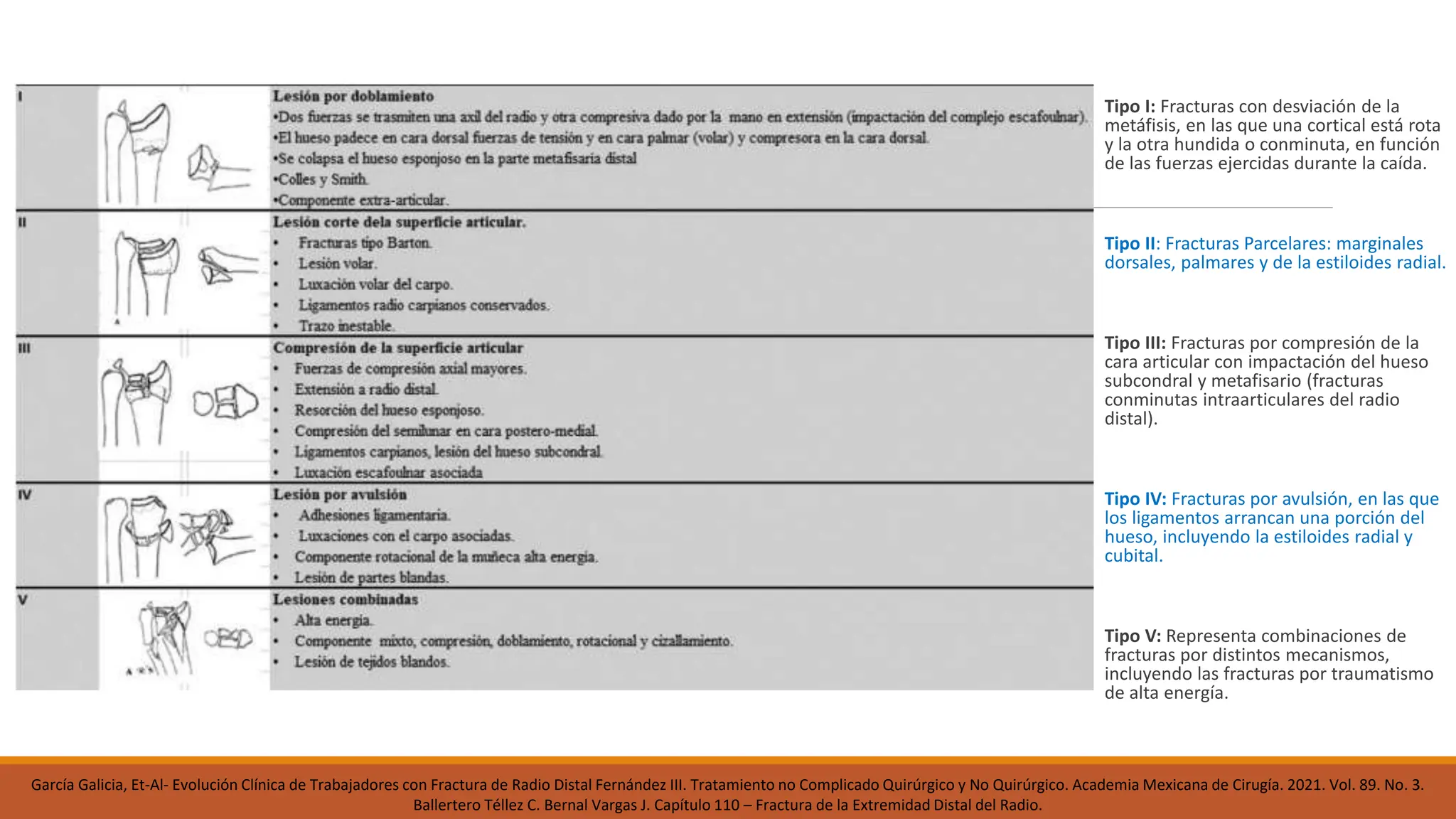 Clasificación Frykman y Fernández Fx Radio Distal | PPTX | Death ...